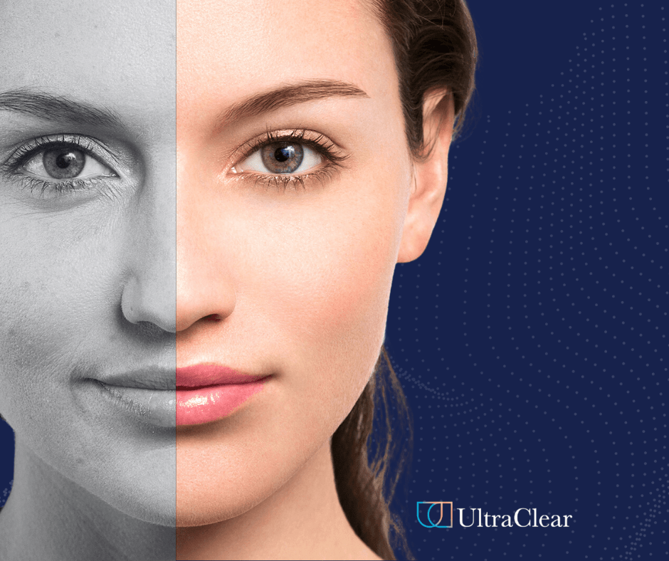 UltraClear Laser: Advanced Skin Rejuvenation Technology
